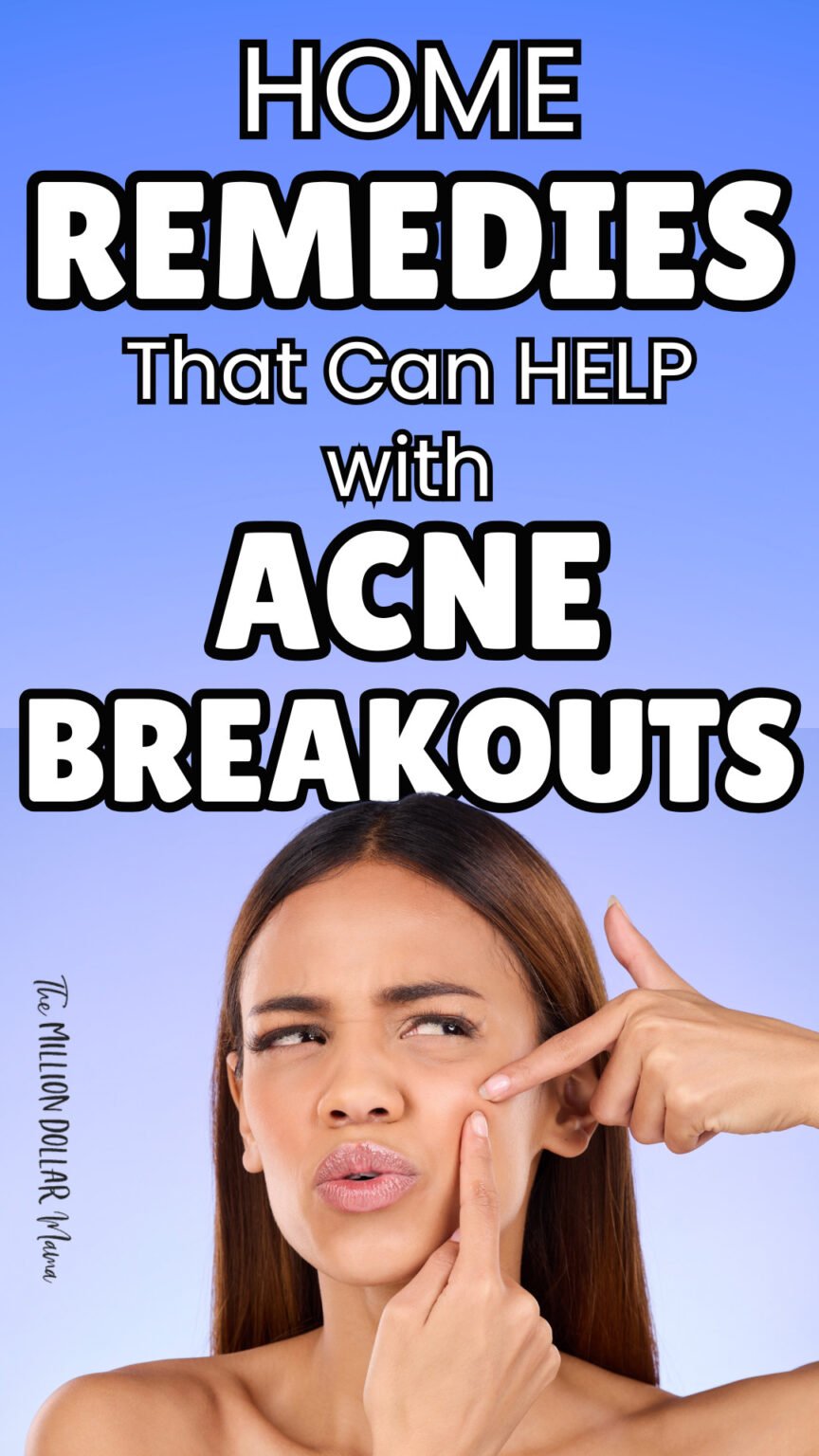 Home Remedies That Can Help Acne Breakouts