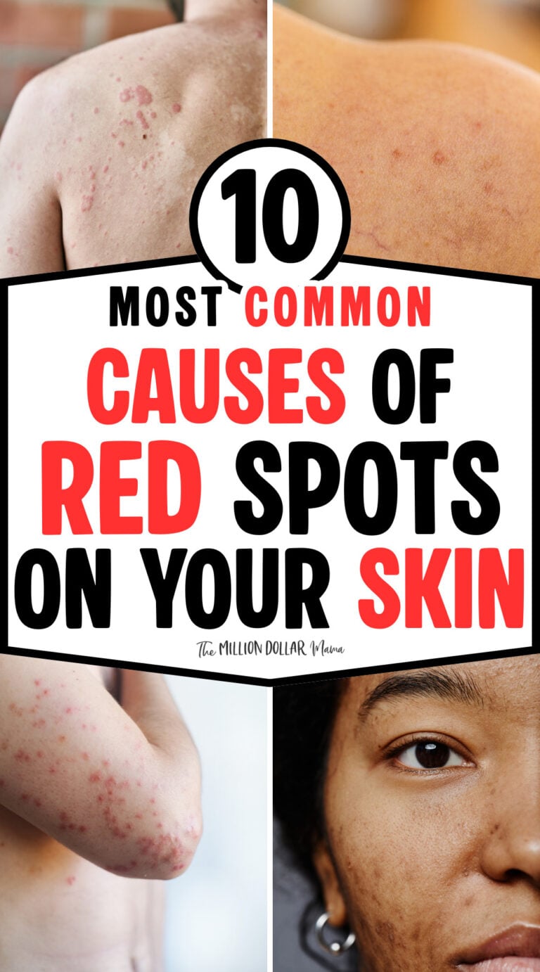 10 Common Causes of Red Spots on Your Skin